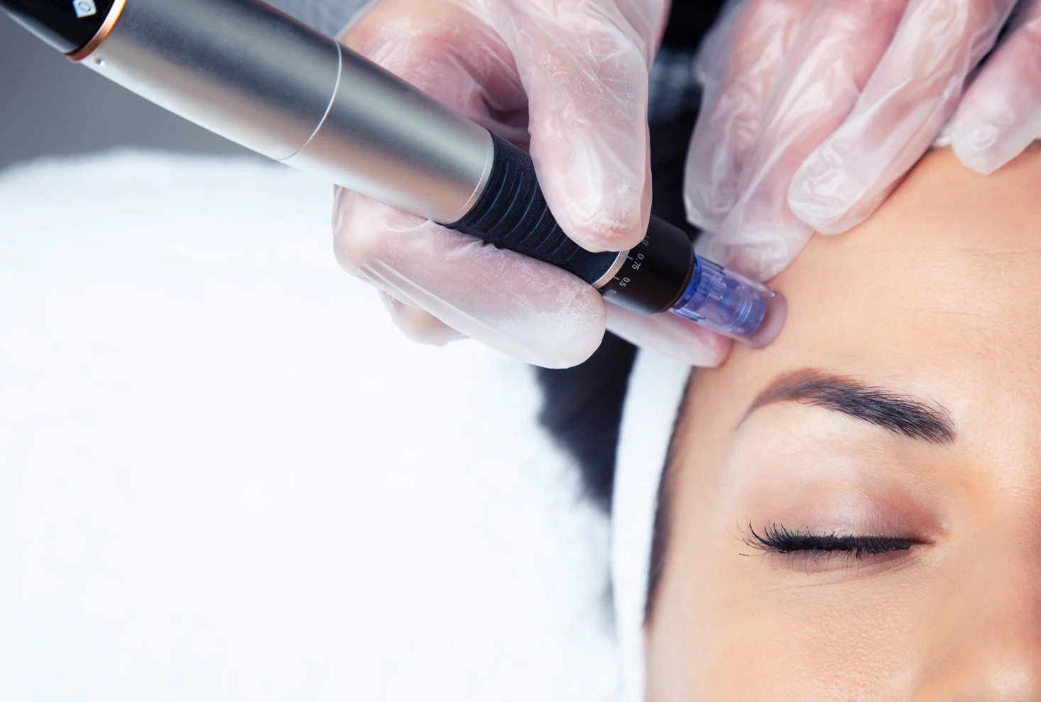 Facials in Swords Dublin | Skin Treatments & Aesthetic Facials